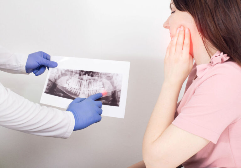 The Different Types of Impacted Wisdom Teeth (And What They Mean for ...