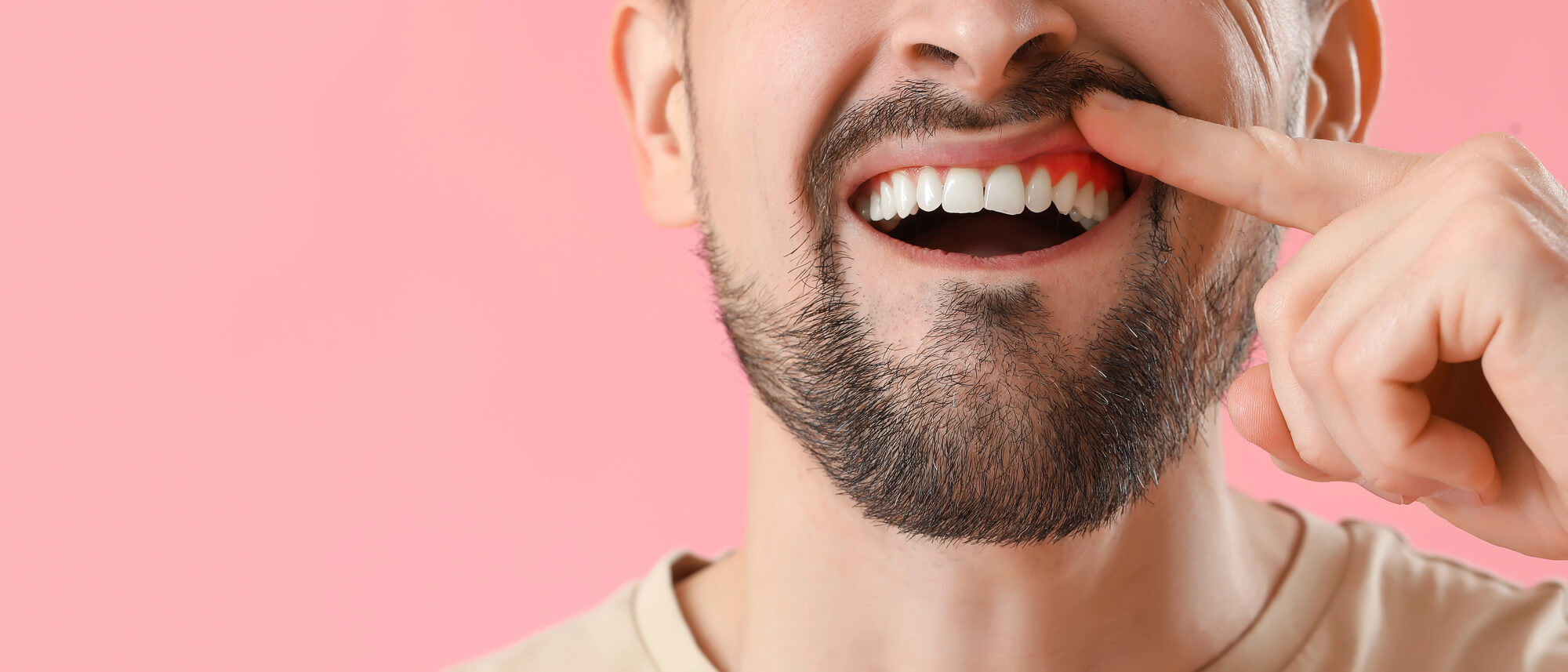 Dark Red Gums: Why Are My Gums Red & What Does It Mean