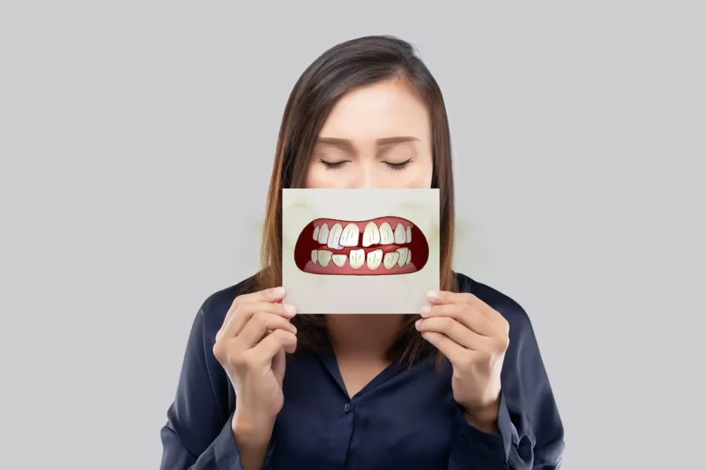 How Tooth Decay Develops Over Time - Champagne Dental Care